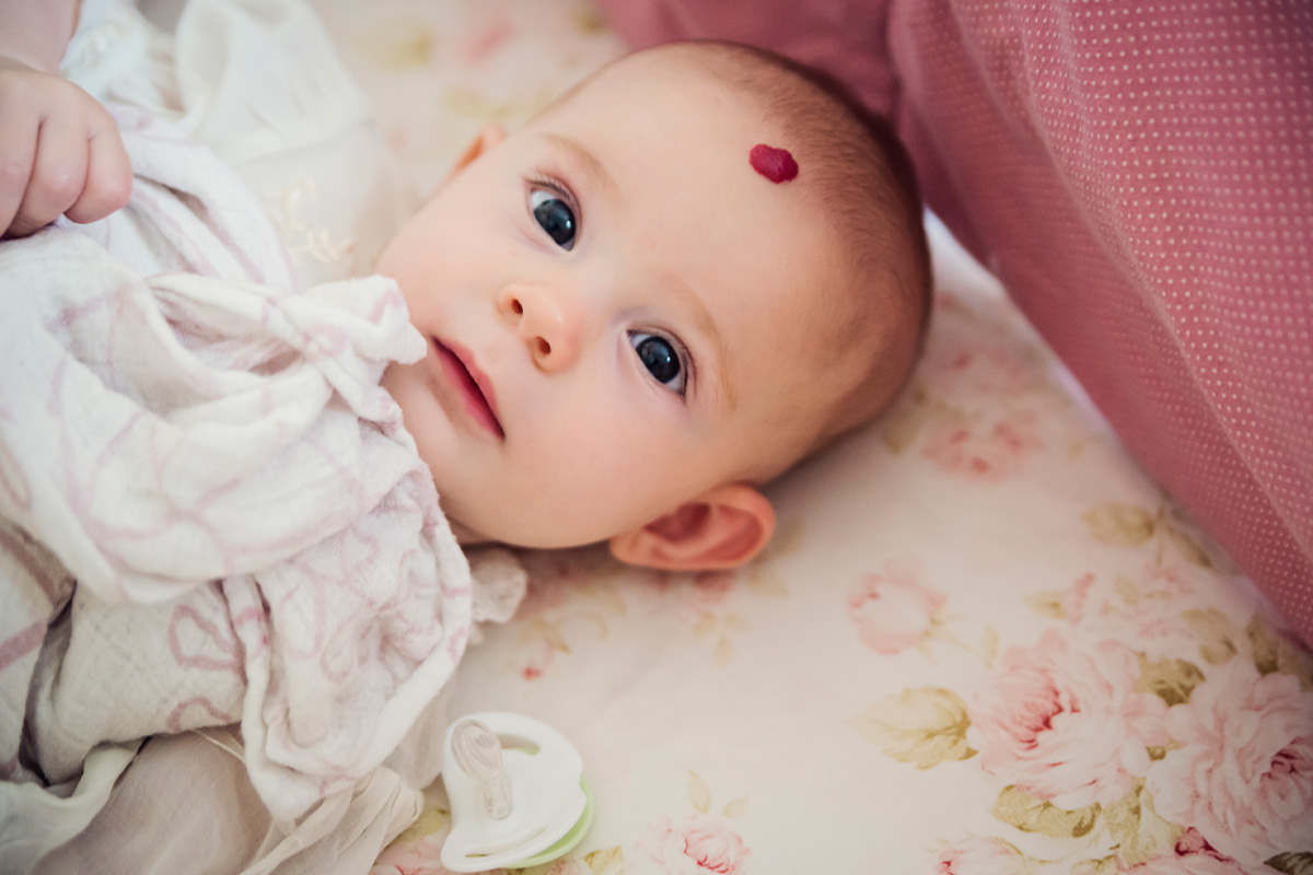 About Infantile Hemangiomas | Vascular Birthmark Institute in NYC