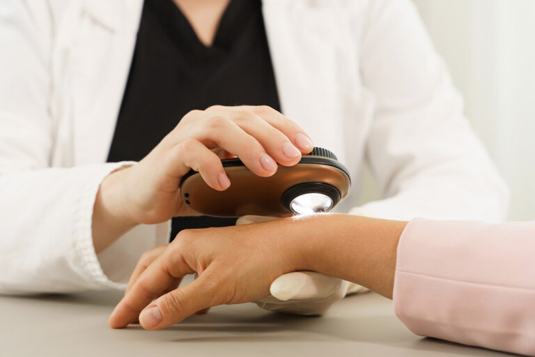 Pyogenic Granuloma in NYC | Vascular Birthmark Institute